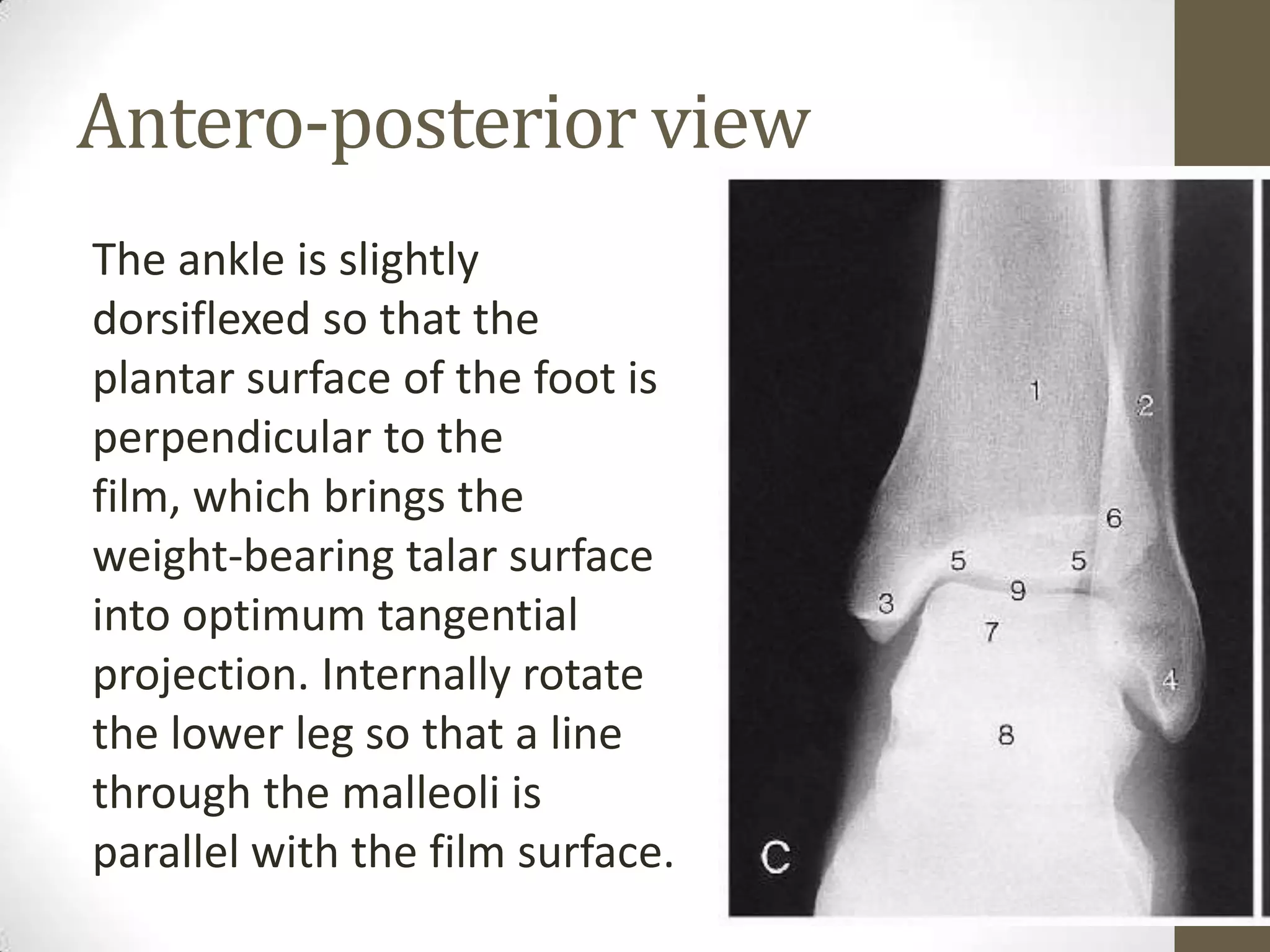 Ankle joint radiography | PPTX