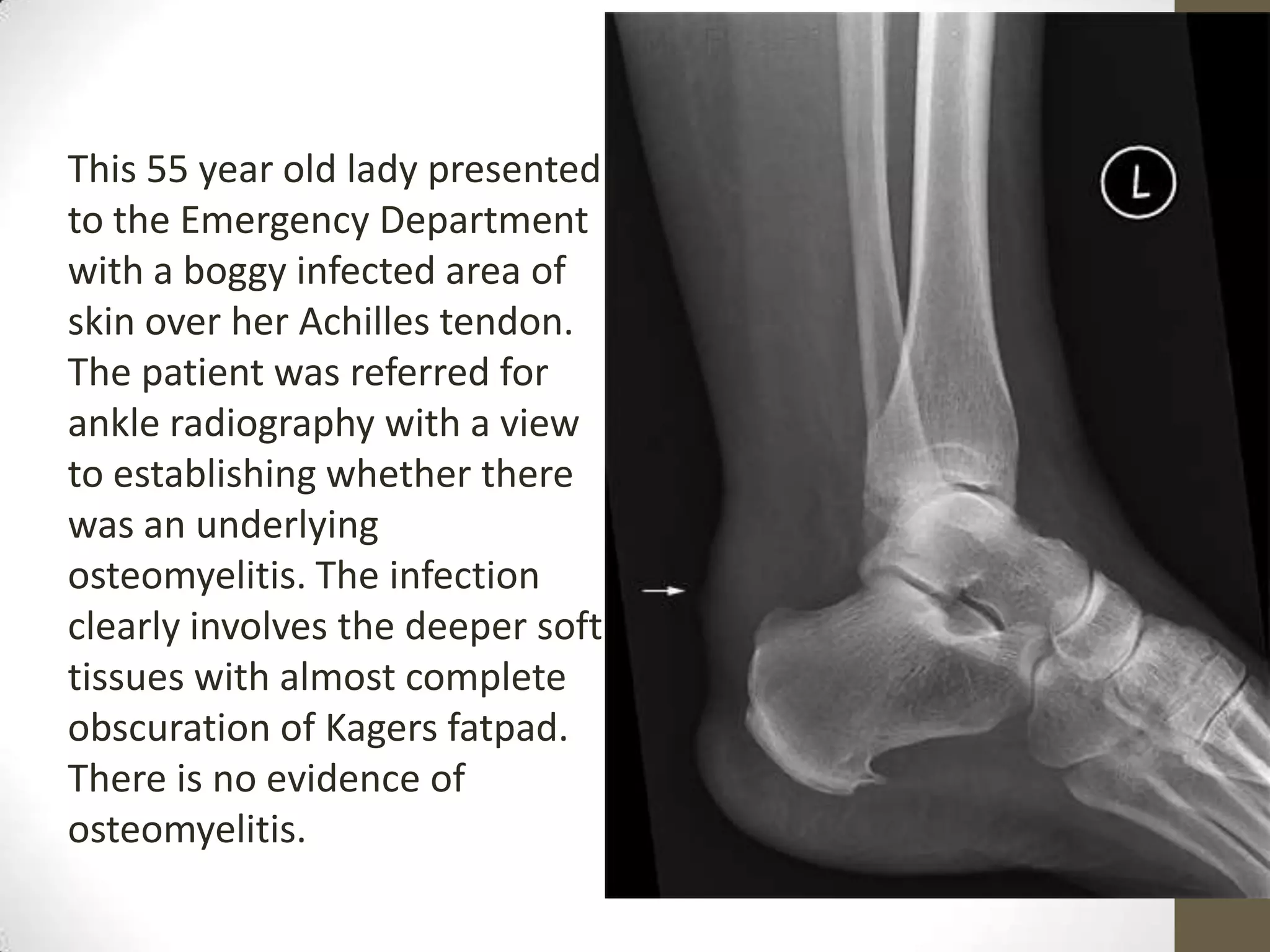 Ankle joint radiography | PPTX