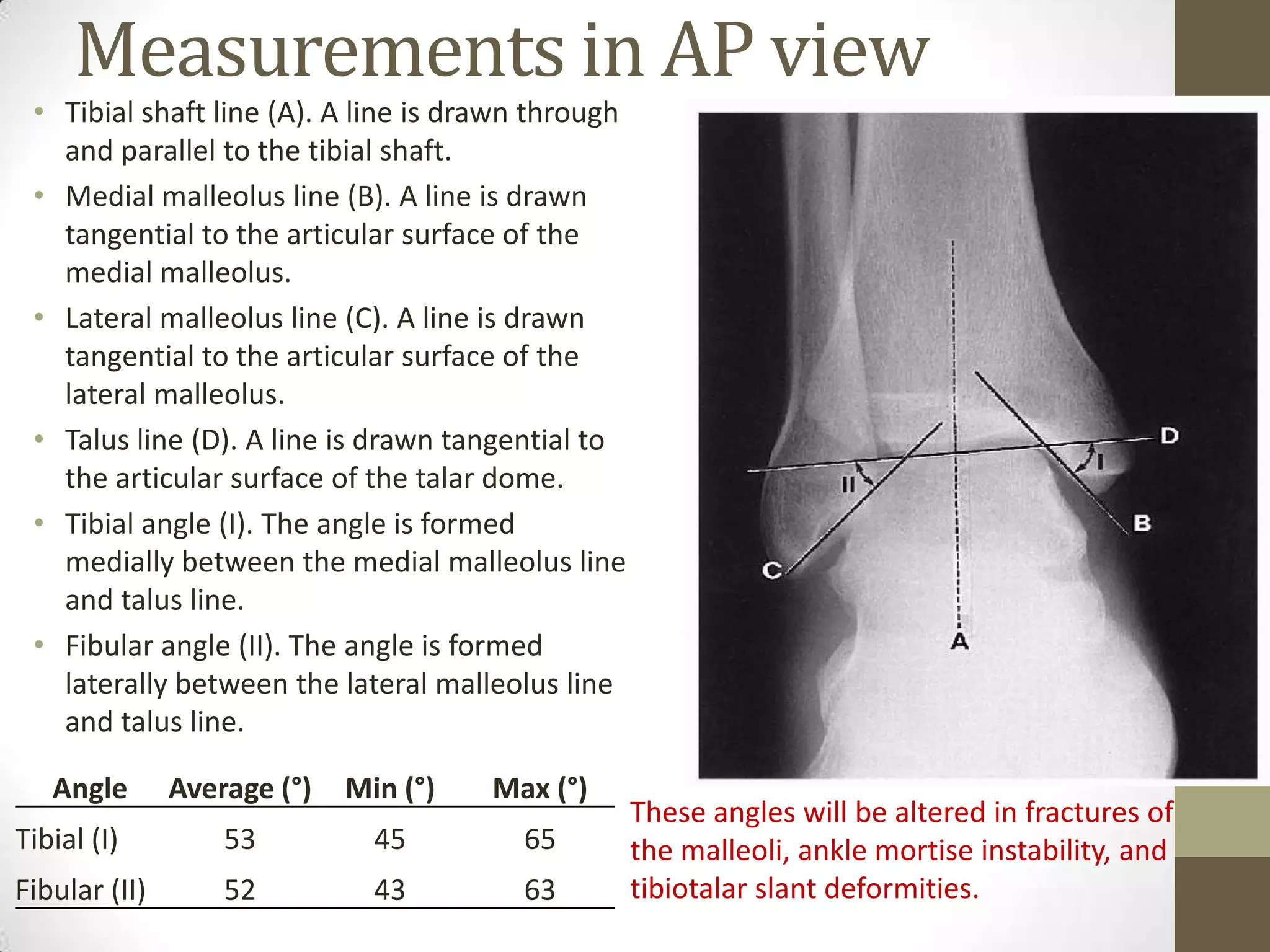 Ankle joint radiography | PPTX