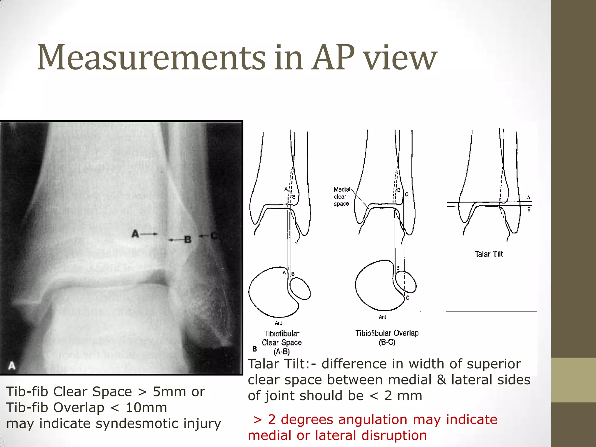 Ankle joint radiography | PPTX
