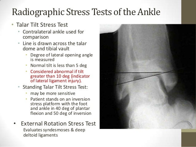 Ankle joint radiography