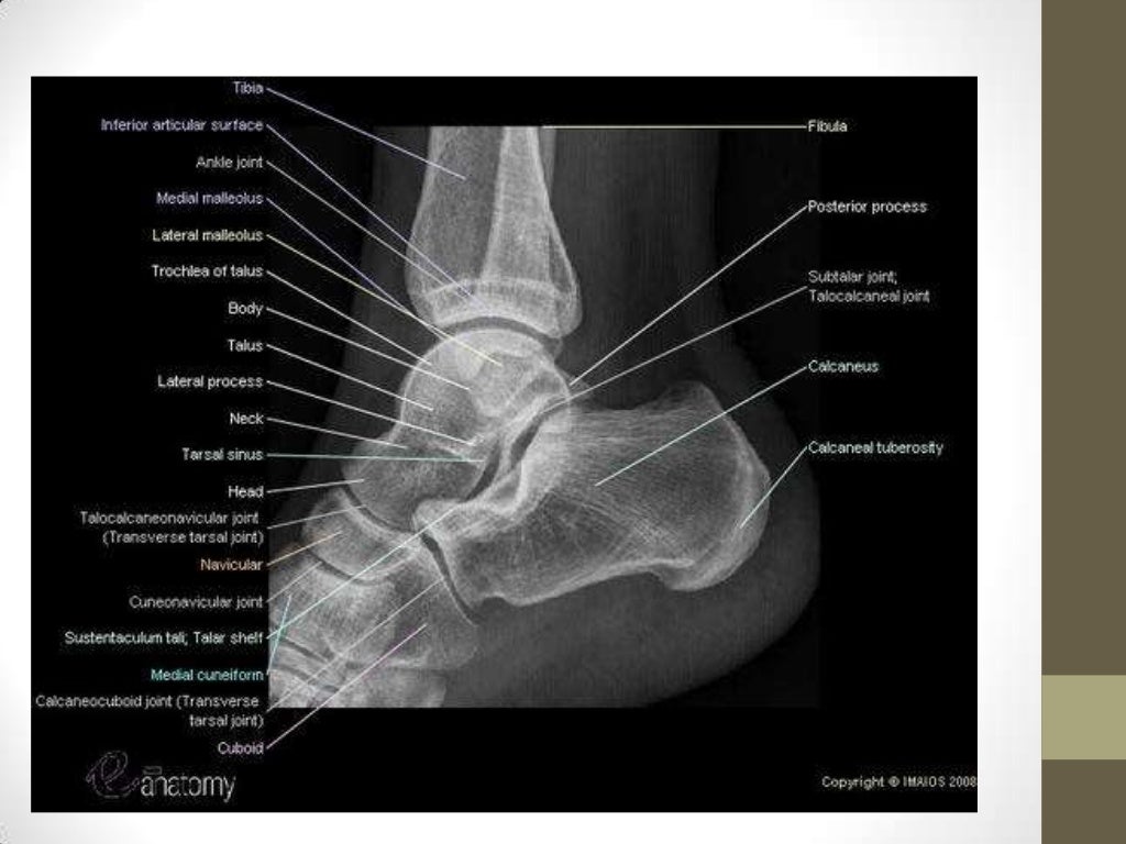 Ankle joint radiography
