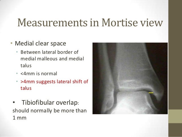 Ankle joint radiography