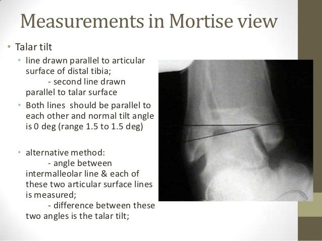 Ankle joint radiography