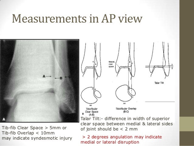Ankle joint radiography