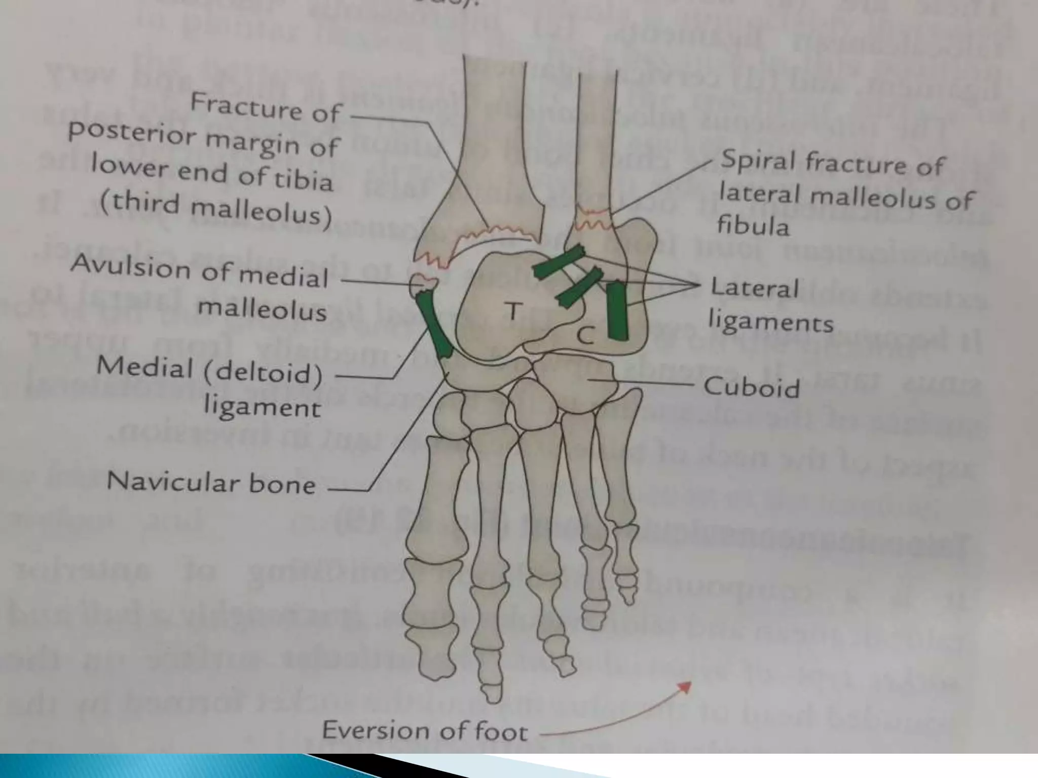 Ankle joint Anatomy | PPTX