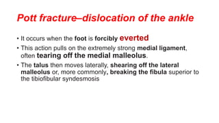 Ankle Joint (TALOCRURAL JOINT) Dr M Arshad.pptx