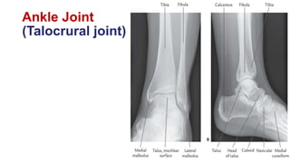 Ankle Joint (TALOCRURAL JOINT) Dr M Arshad.pptx