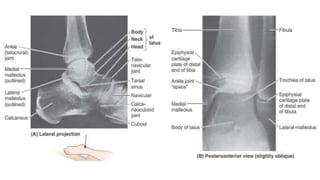 Ankle Joint (TALOCRURAL JOINT) Dr M Arshad.pptx