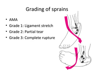 Ankle ligament injuries - Derek Park | PPT