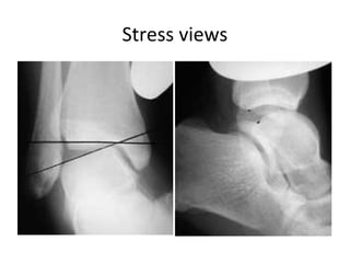Ankle ligament injuries - Derek Park | PPT