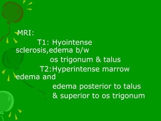 Overuse syndromes of Ankle joint .ppt