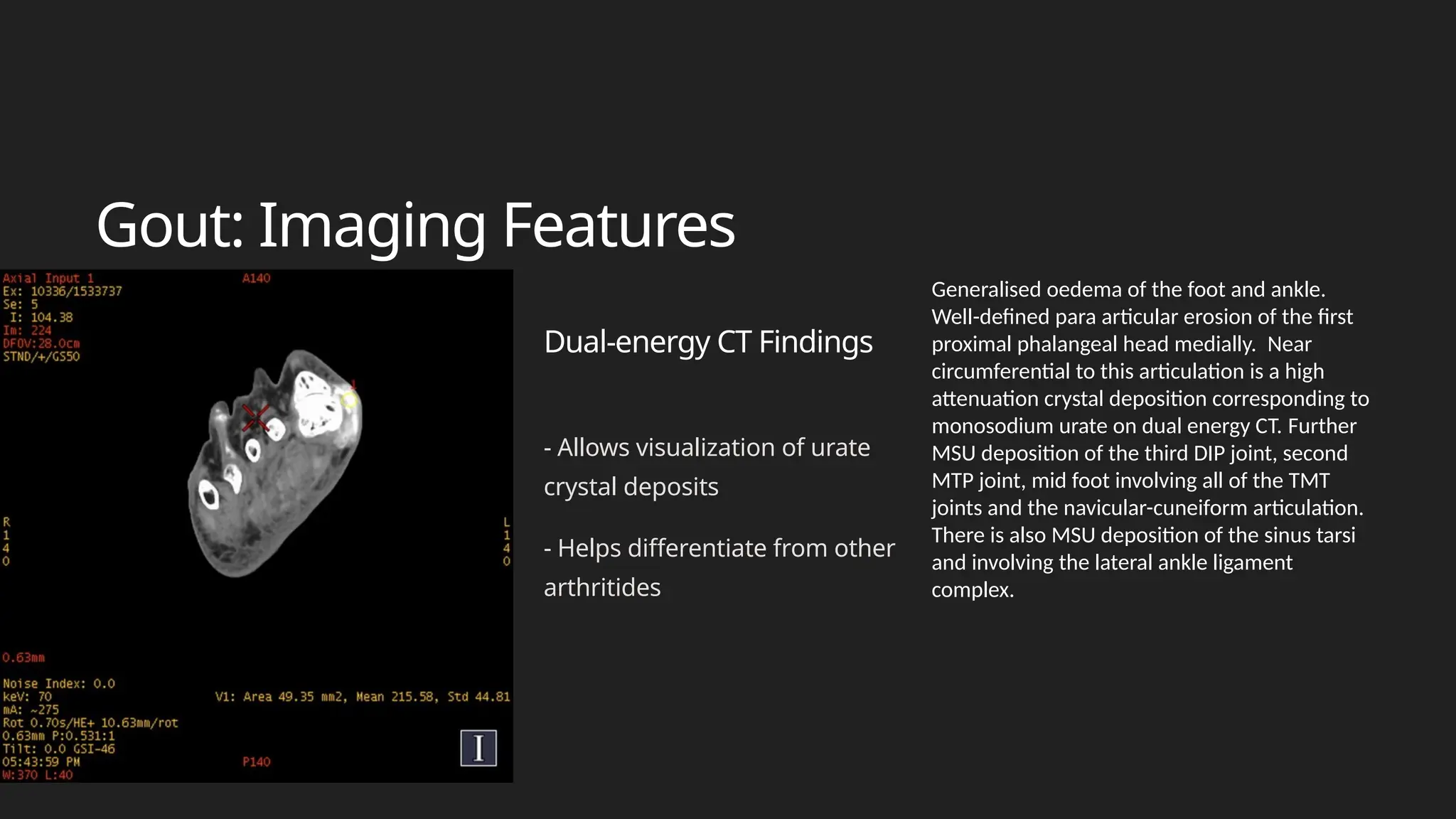 ANKLE PPT FINAL radiologist perspective .pptx