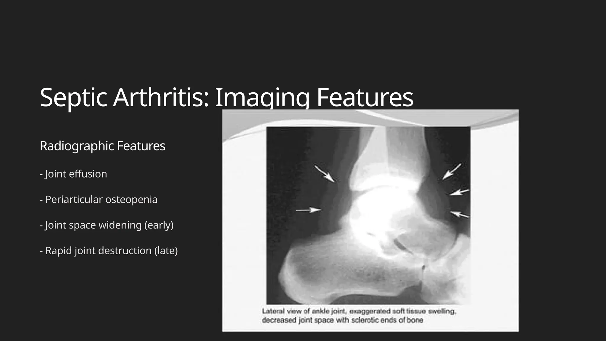 ANKLE PPT FINAL radiologist perspective .pptx
