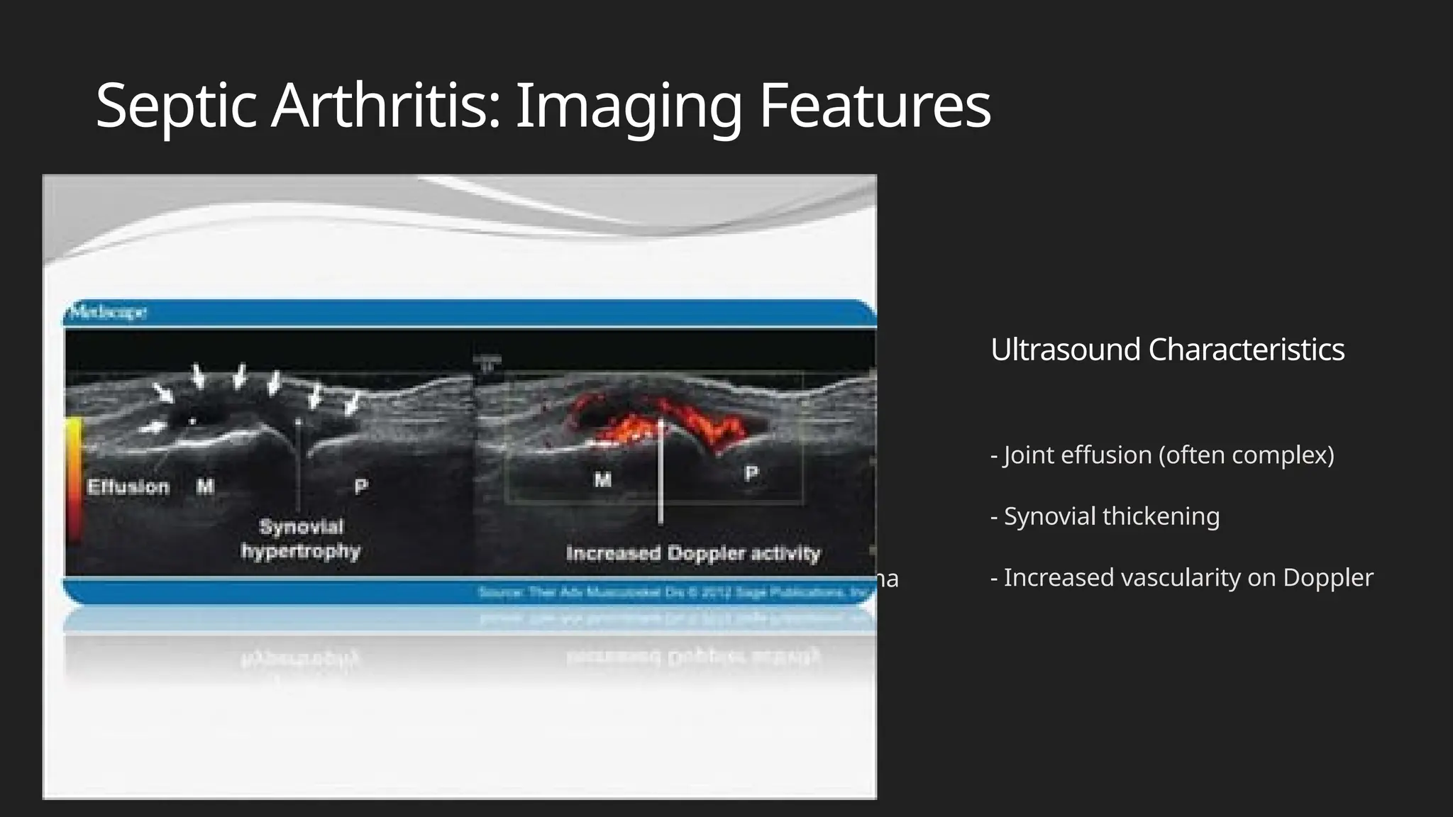 ANKLE PPT FINAL radiologist perspective .pptx