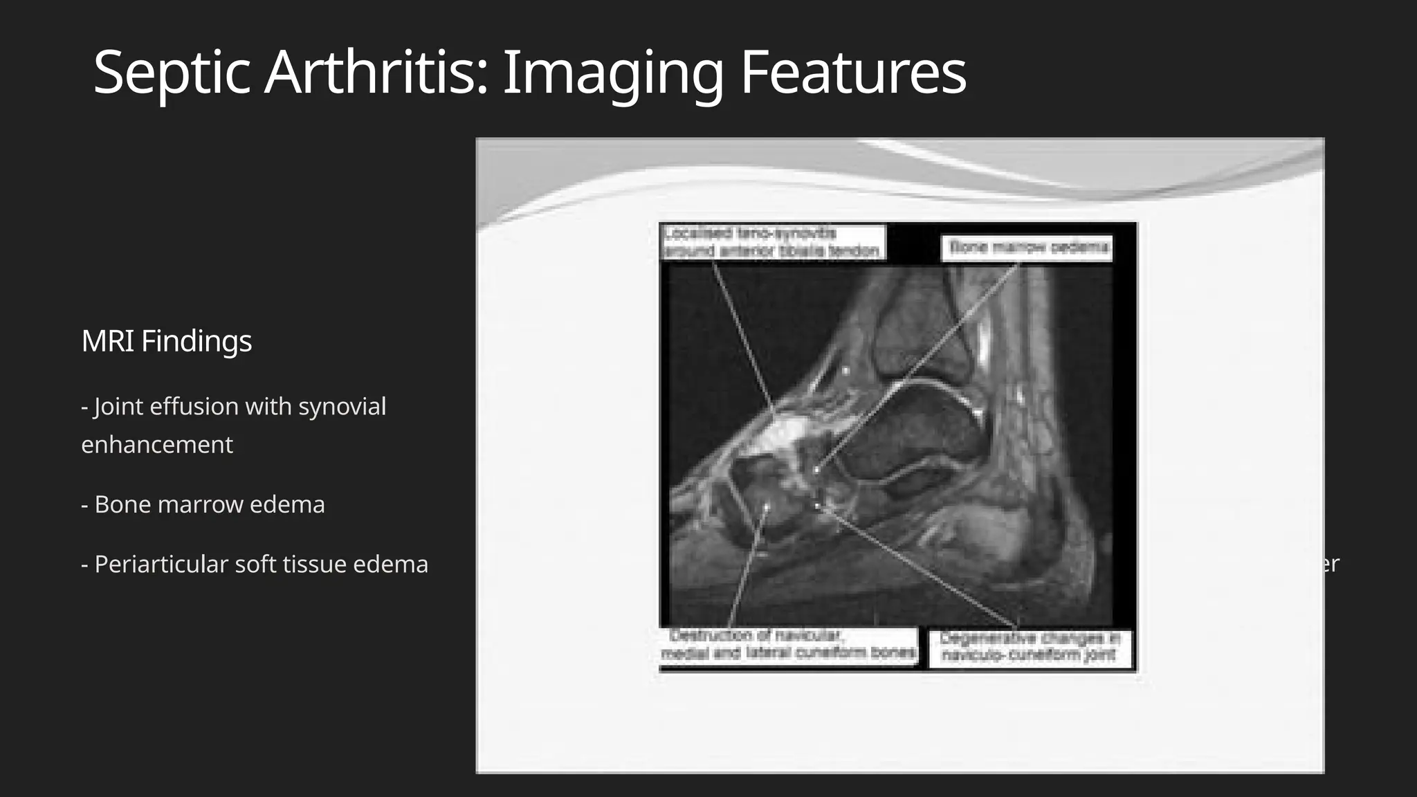ANKLE PPT FINAL radiologist perspective .pptx