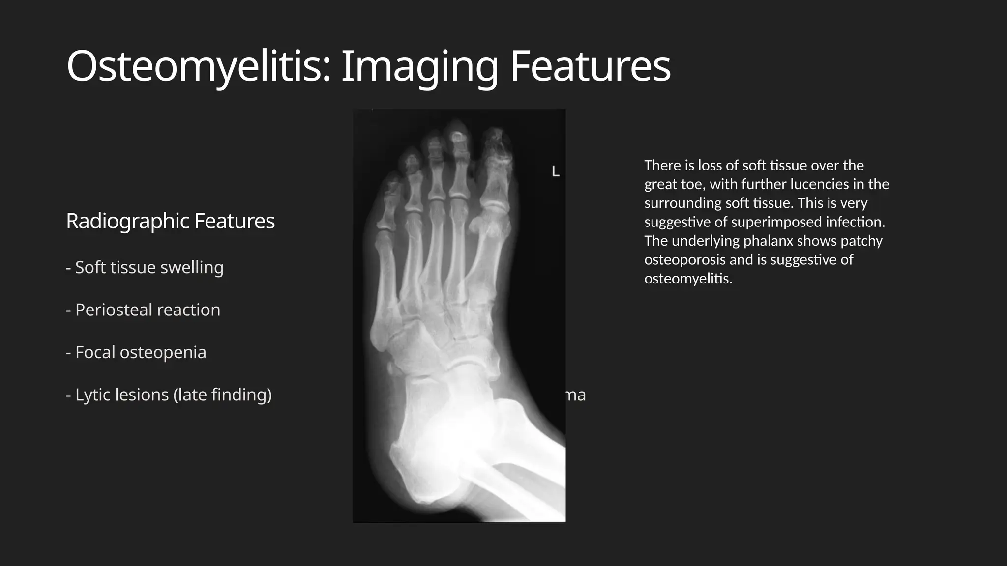 ANKLE PPT FINAL radiologist perspective .pptx