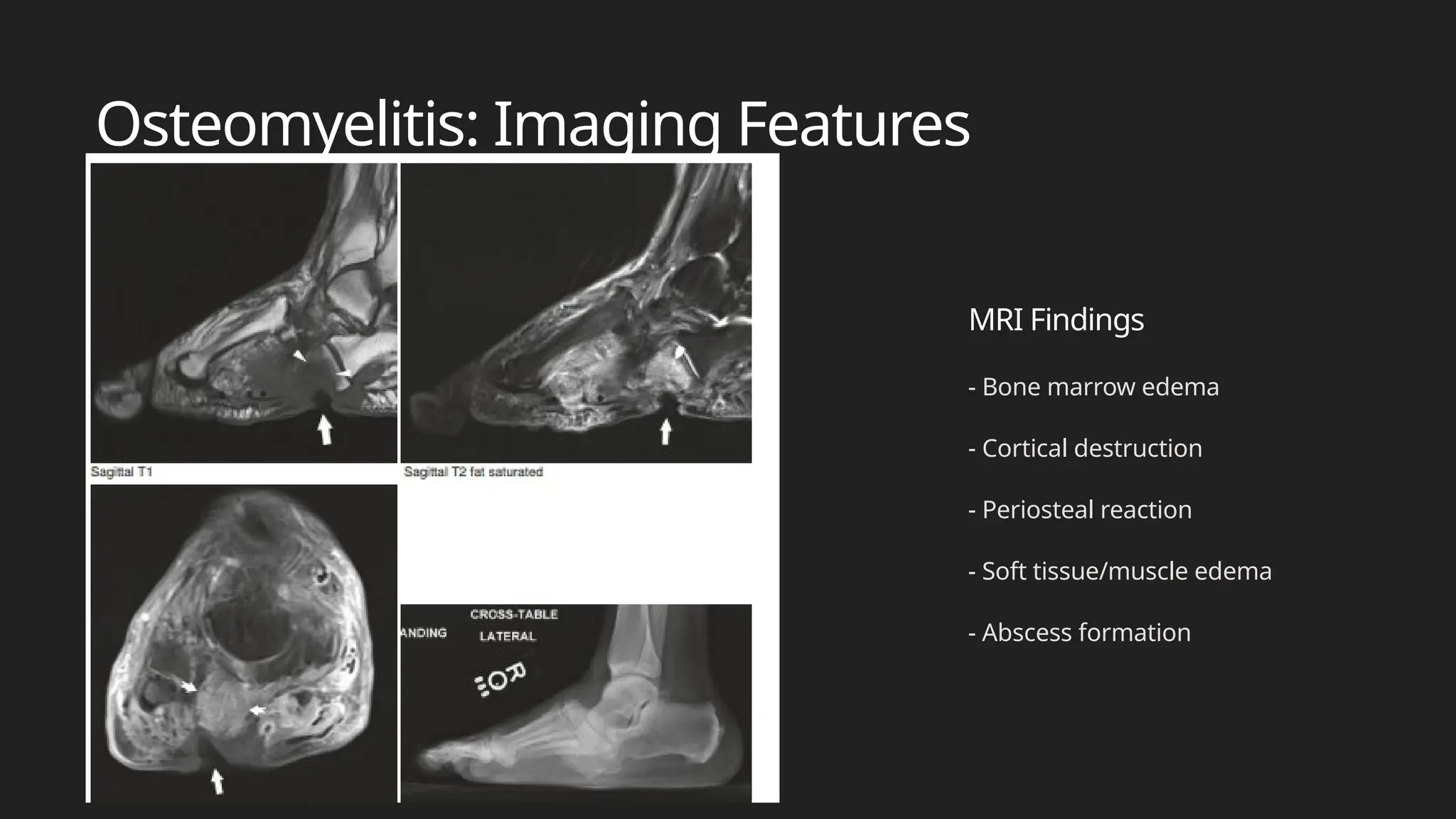 ANKLE PPT FINAL radiologist perspective .pptx