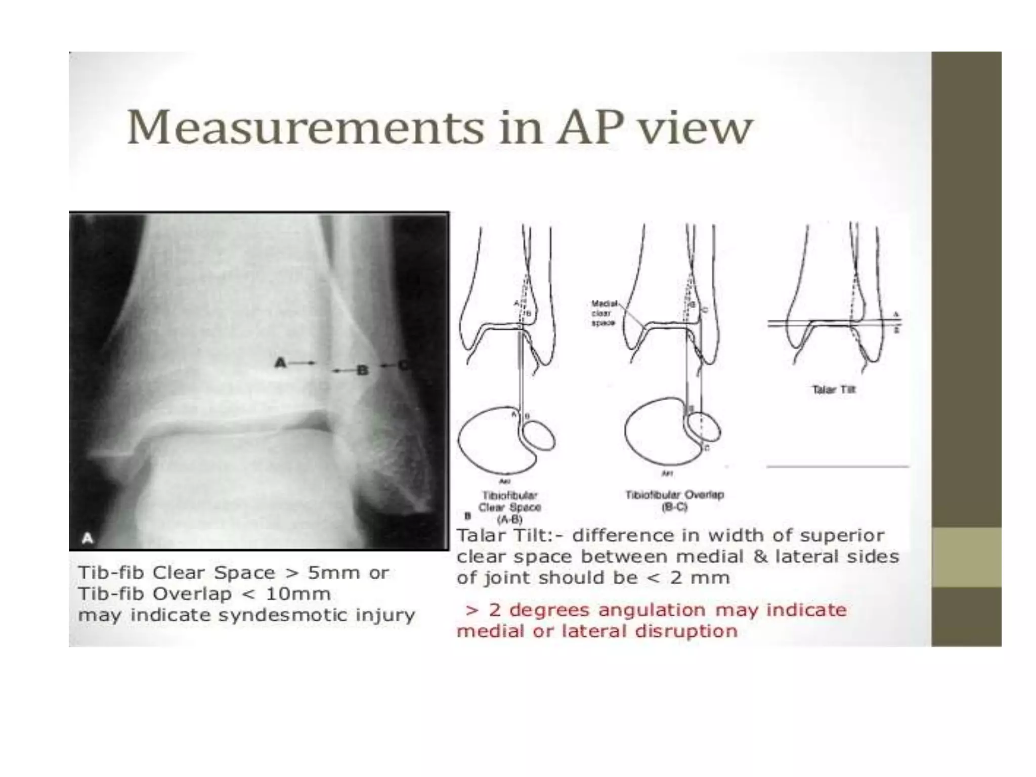Ankle radiological anatomy | PPTX