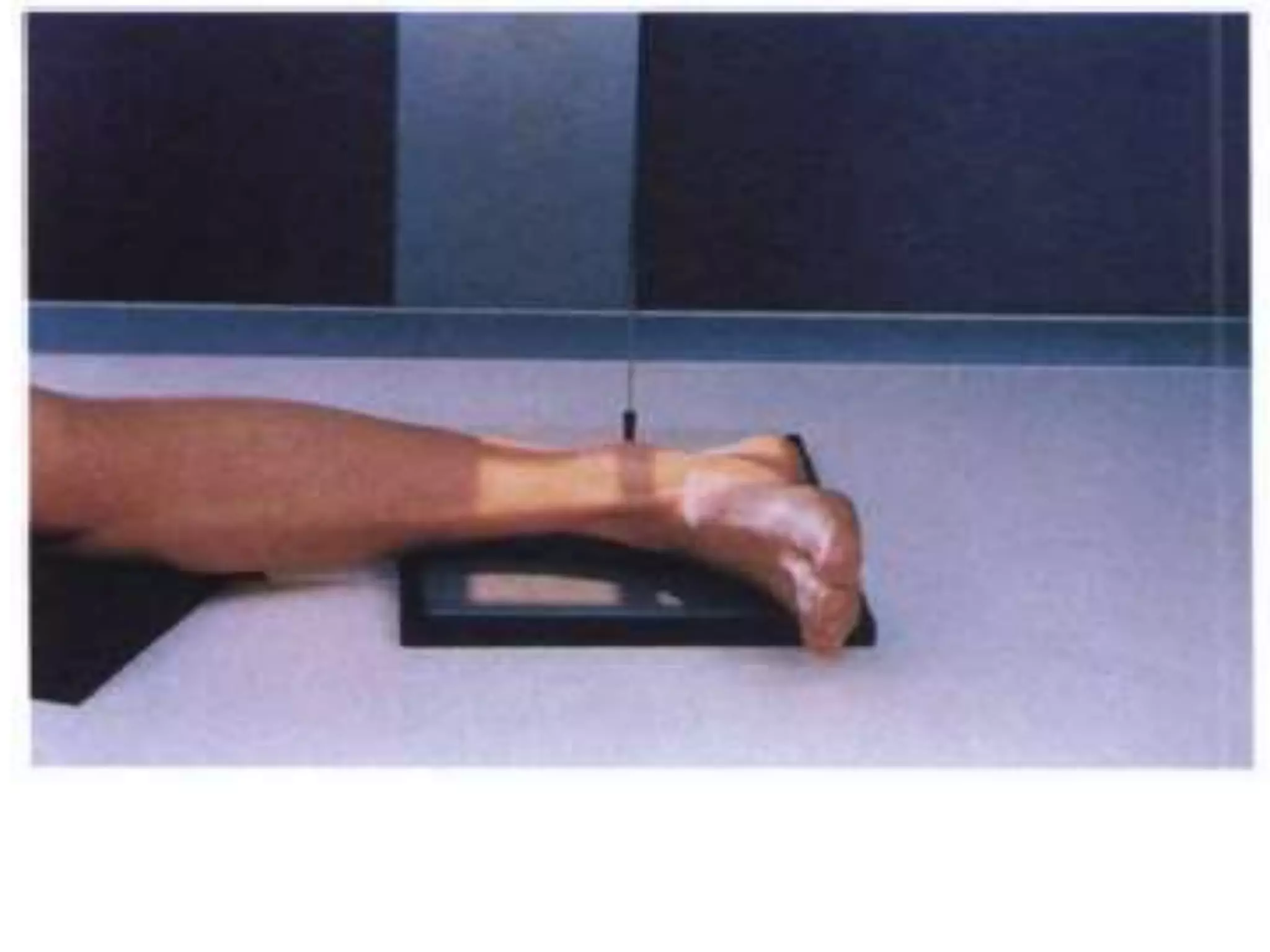 Ankle radiological anatomy | PPTX