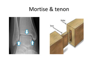 Ankle radiological anatomy | PPTX