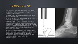 Radiological Features for Evaluation of the Ankle | PPTX