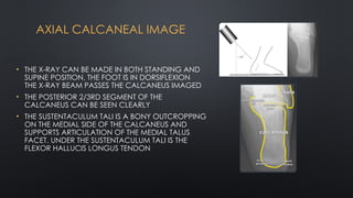 Radiological Features for Evaluation of the Ankle | PPTX