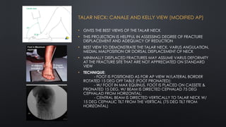 Radiological Features for Evaluation of the Ankle | PPT