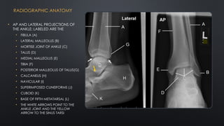 Radiological Features for Evaluation of the Ankle | PPT