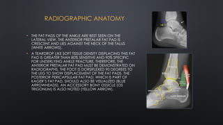Radiological Features for Evaluation of the Ankle | PPT