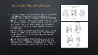 Radiological Features for Evaluation of the Ankle | PPT