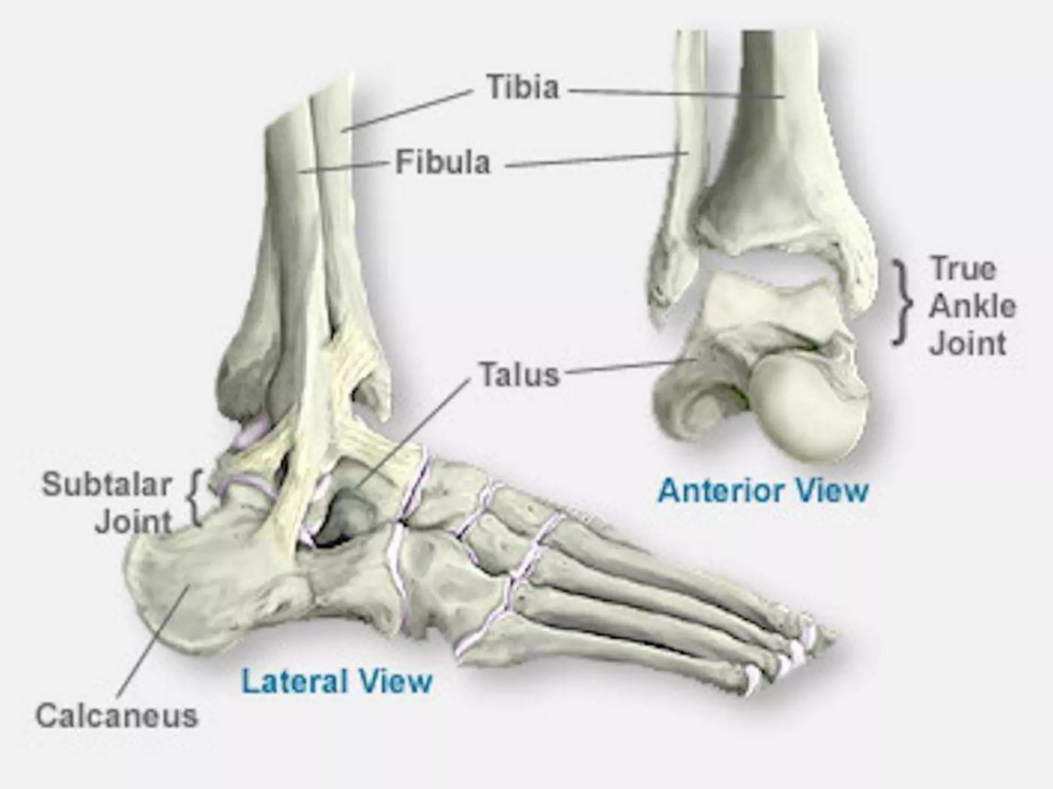 Ankle sprain | PPTX