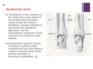 Ankle sprain | PPTX | Death, Injury, or Military Conflict | Sensitive ...