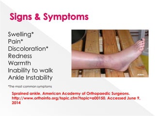 Ankle sprain | PPTX