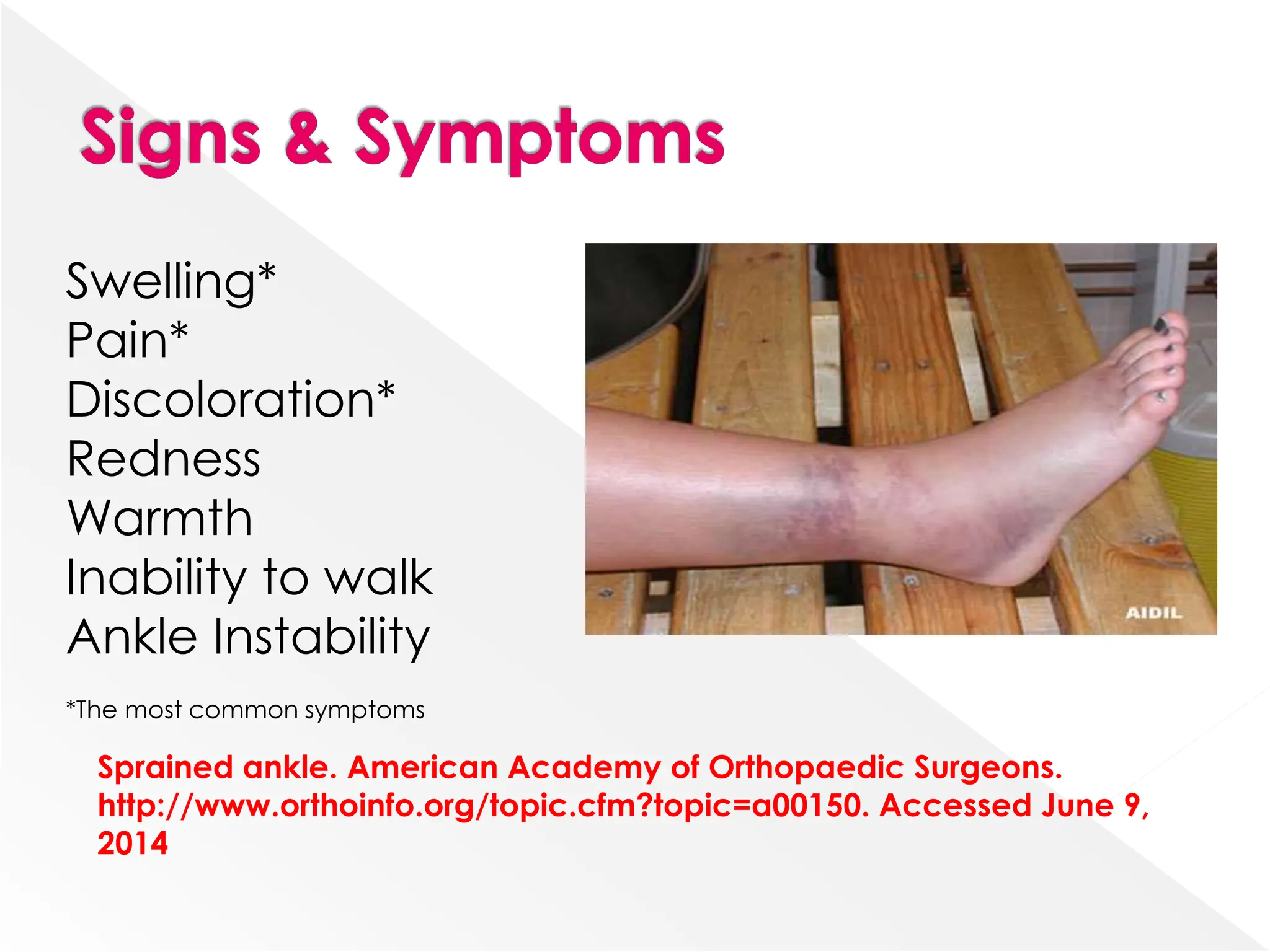 ankle sprain.pdf | Death, Injury, or Military Conflict | Sensitive Topics