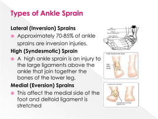 ankle sprain.pdf | Death, Injury, or Military Conflict | Sensitive Topics