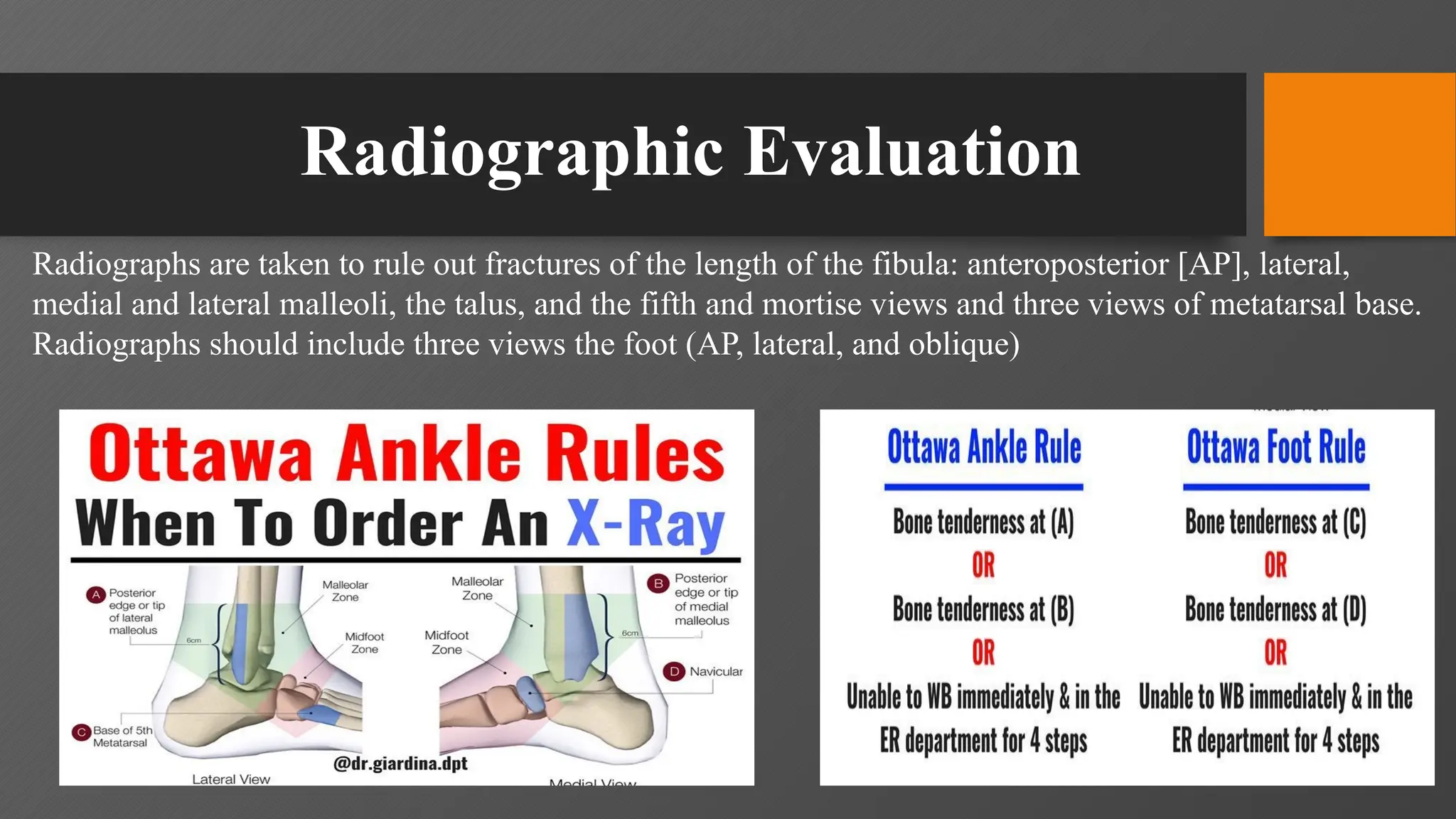 Ankle Sprain mechanism of injury physiotherapeutic assessment and ...