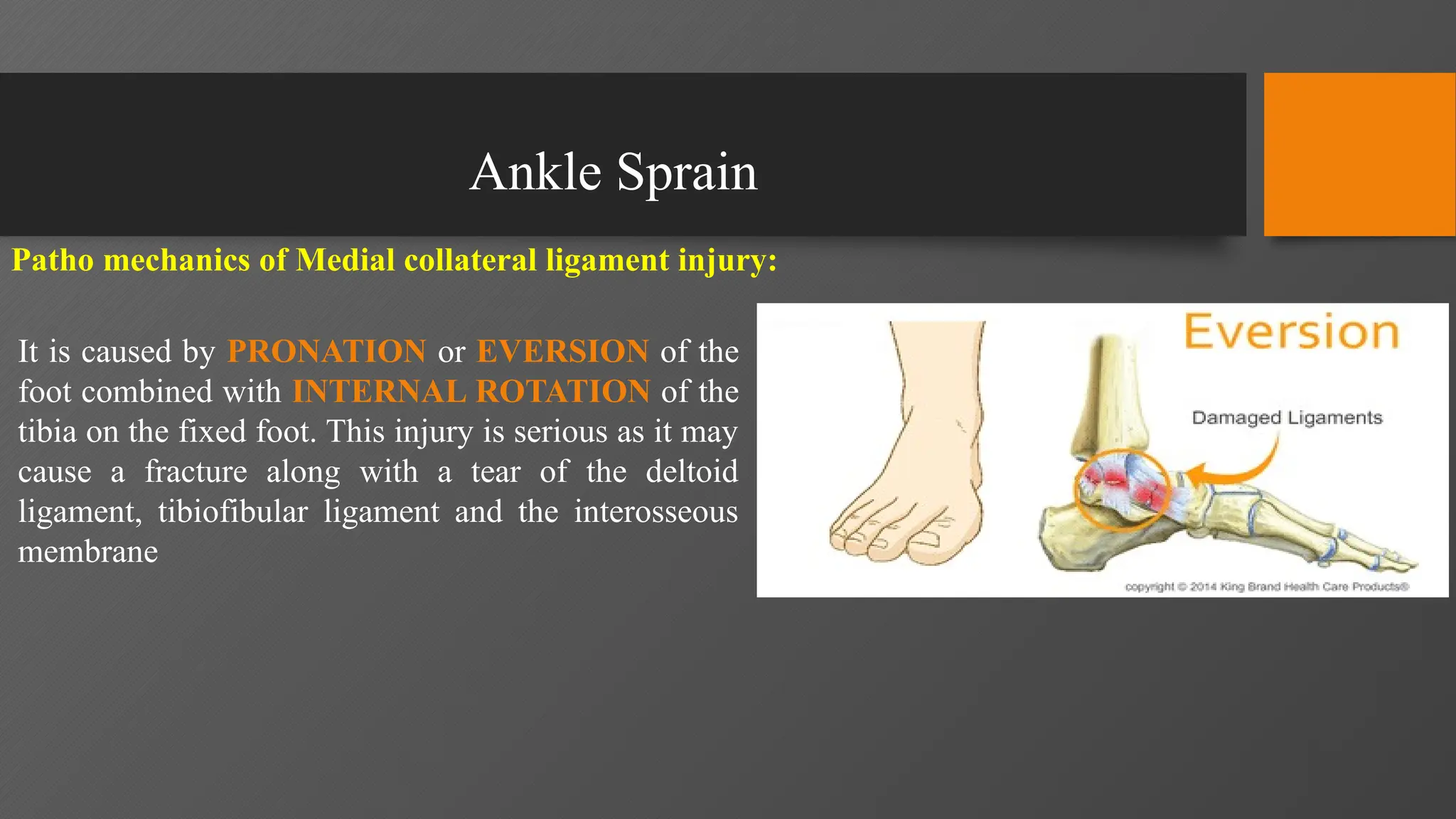 Ankle Sprain mechanism of injury physiotherapeutic assessment and ...