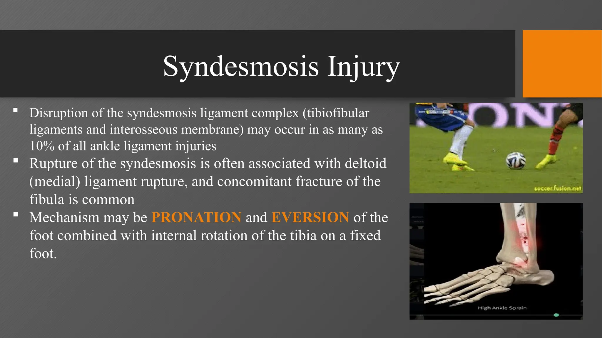 Ankle Sprain mechanism of injury physiotherapeutic assessment and ...