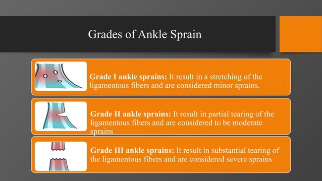 Ankle Sprain mechanism of injury physiotherapeutic assessment and ...