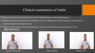 Ankle Sprain mechanism of injury physiotherapeutic assessment and ...