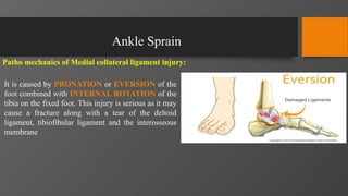 Ankle Sprain mechanism of injury physiotherapeutic assessment and ...