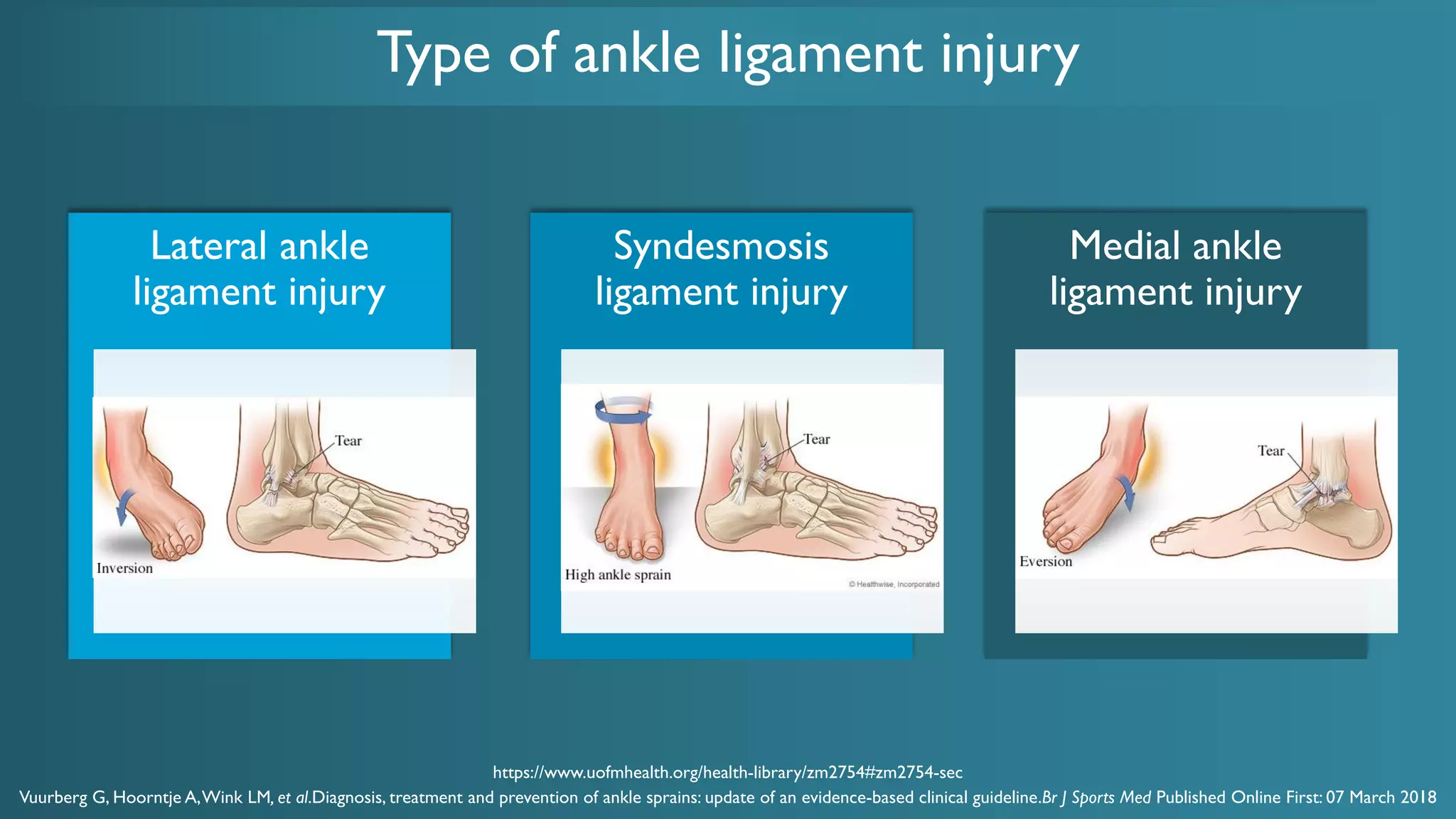 Ankle Sprain Final Version.pdf
