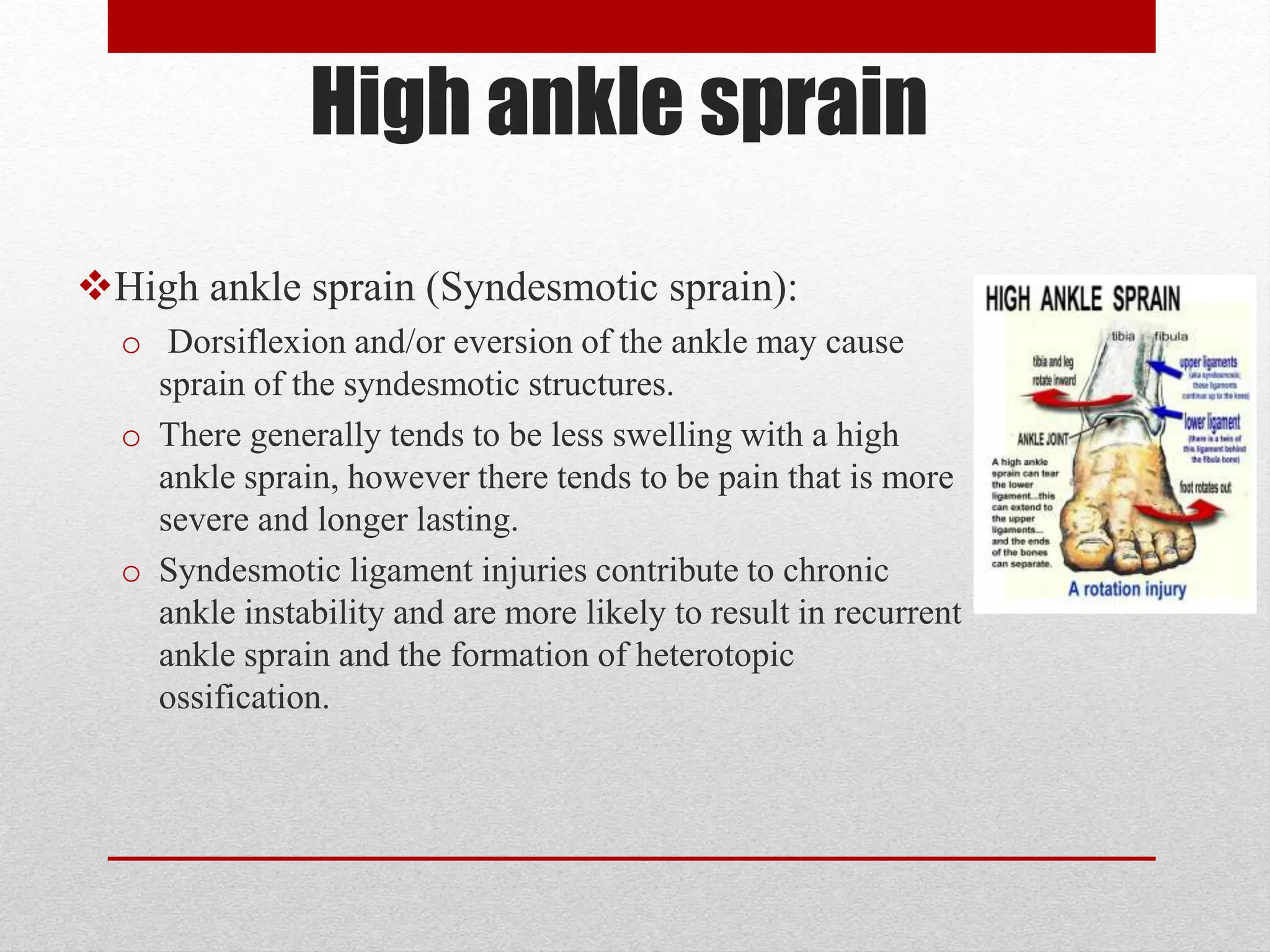 Ankle Sprain | PPTX