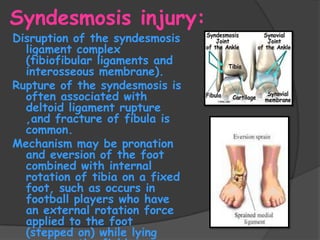 Ankle Sprains | PPTX