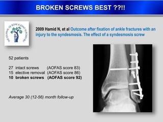 Ankle Syndesmosis TightRope | PPTX