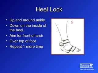 How to Tape An Ankle | PPT