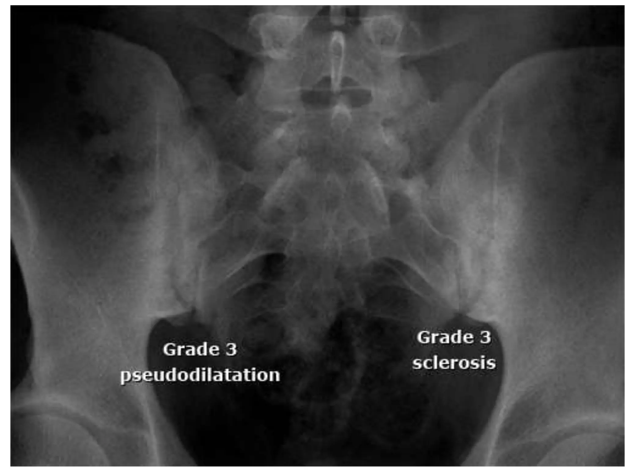 Ank spond and dish | PPTX