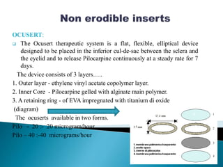 ocular drug delivery system | PPT