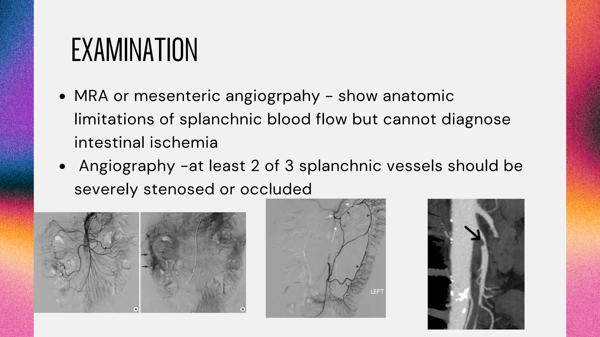 Chronic mesentric ischemia internal medicine | PDF